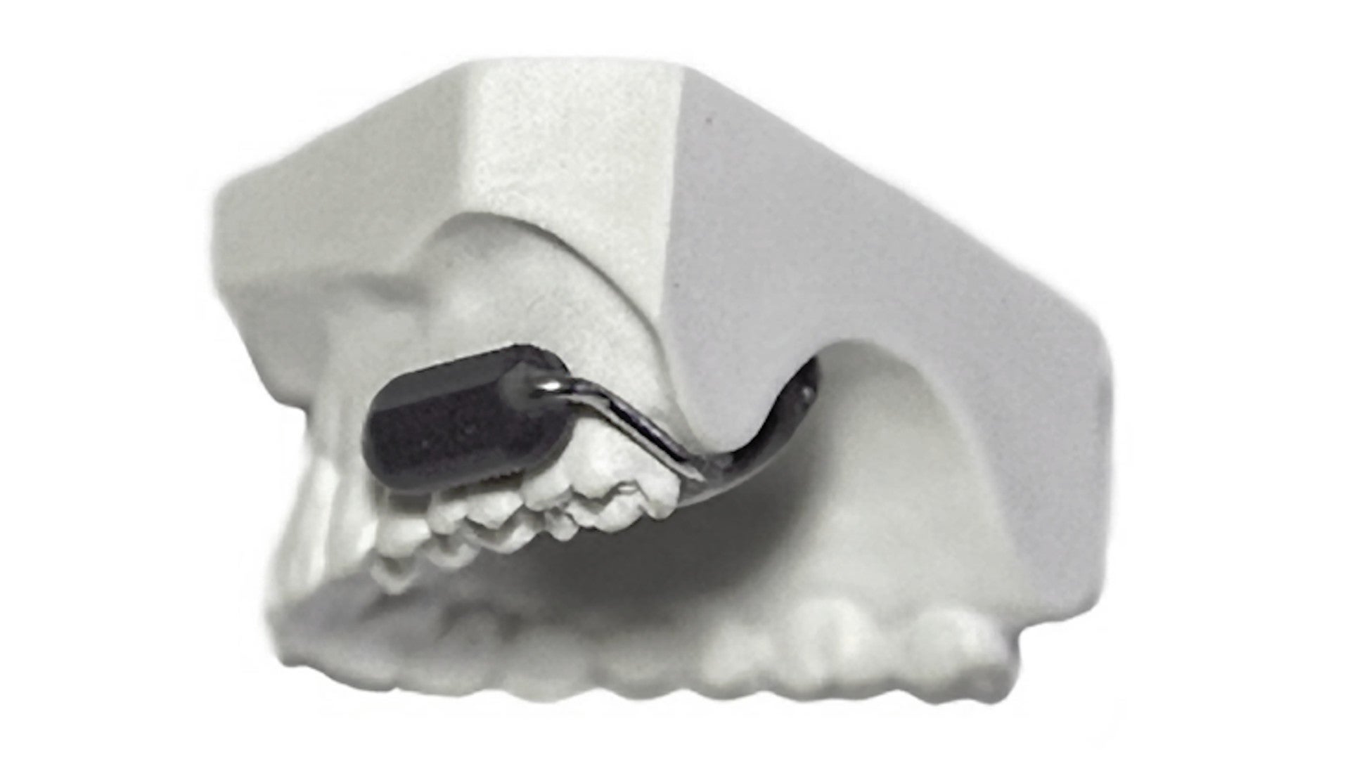 The Pentagon's Tiny Covert Mics That Clip Onto Your Teeth Are A Game ...